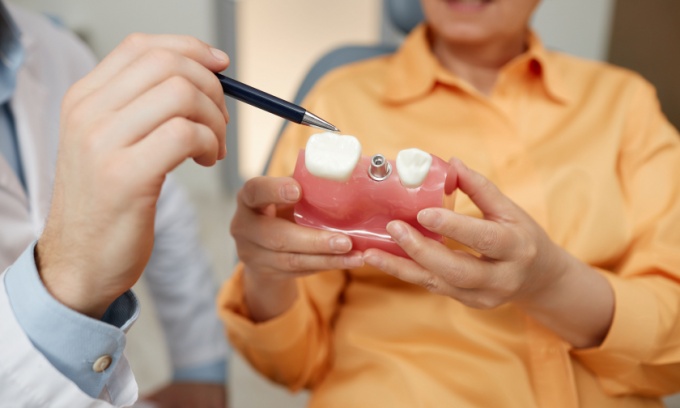 How Much Do Single-Tooth Dentures Cost? | Canstar